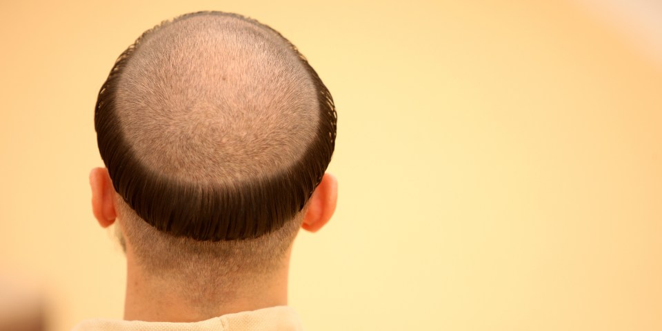 Por que os monges usam cortes de cabelo estranhos?